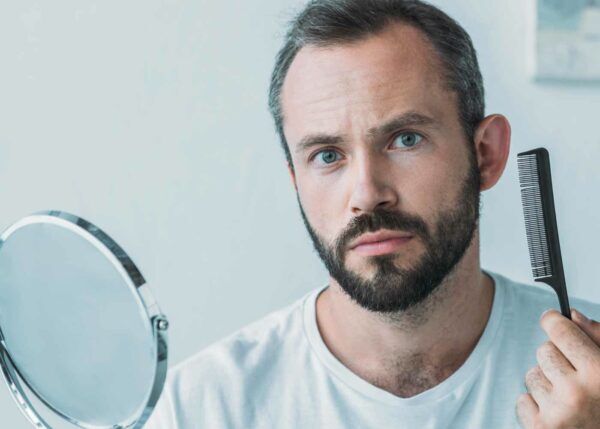 Début de calvitie - Quel âge, les signes, les stades